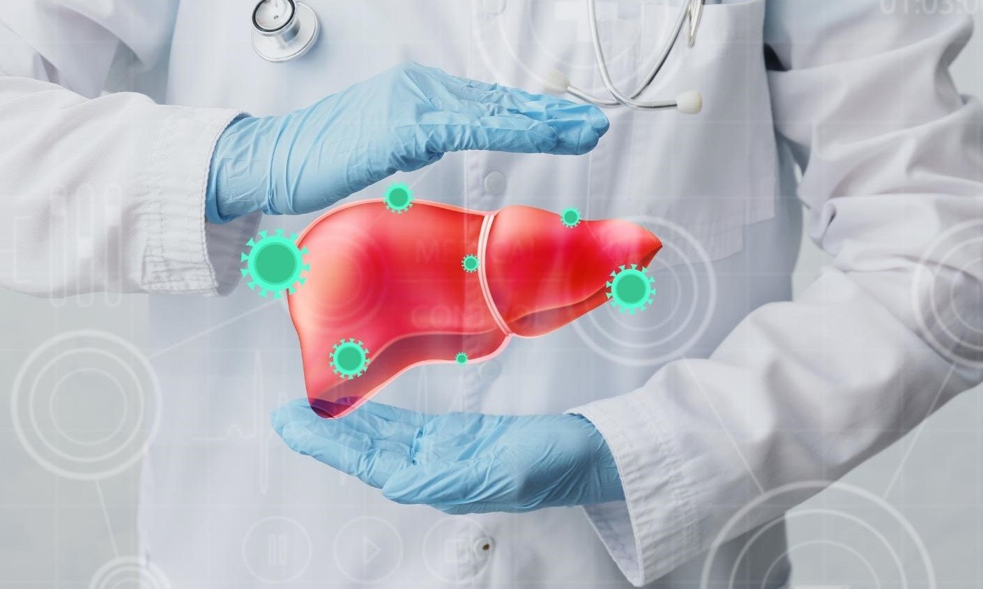 ¿Cuáles son los síntomas de la hepatitis C? - Lorgen