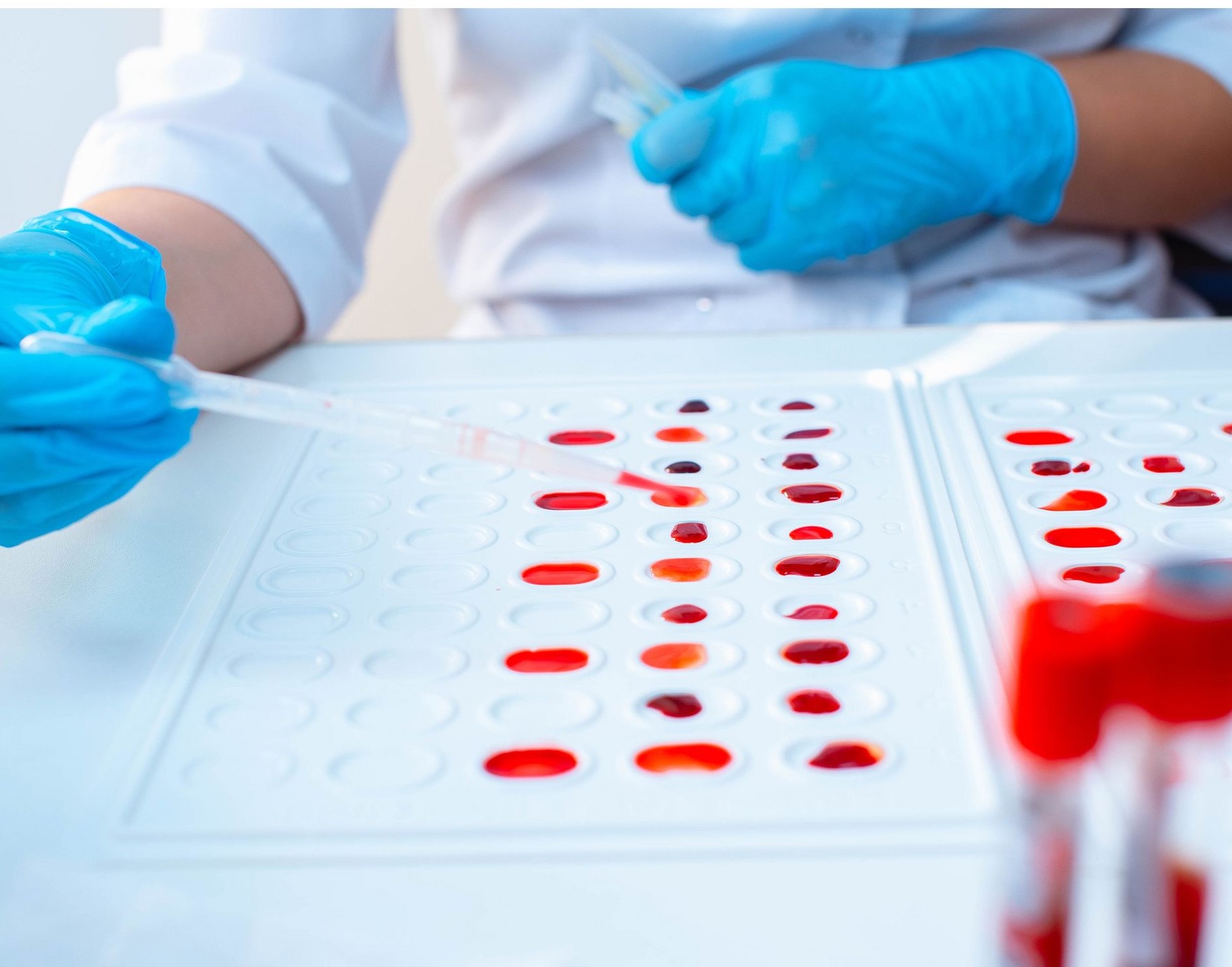 DETERMINACIÓN GRUPO SANGUÍNEO Y Rh - Lorgen