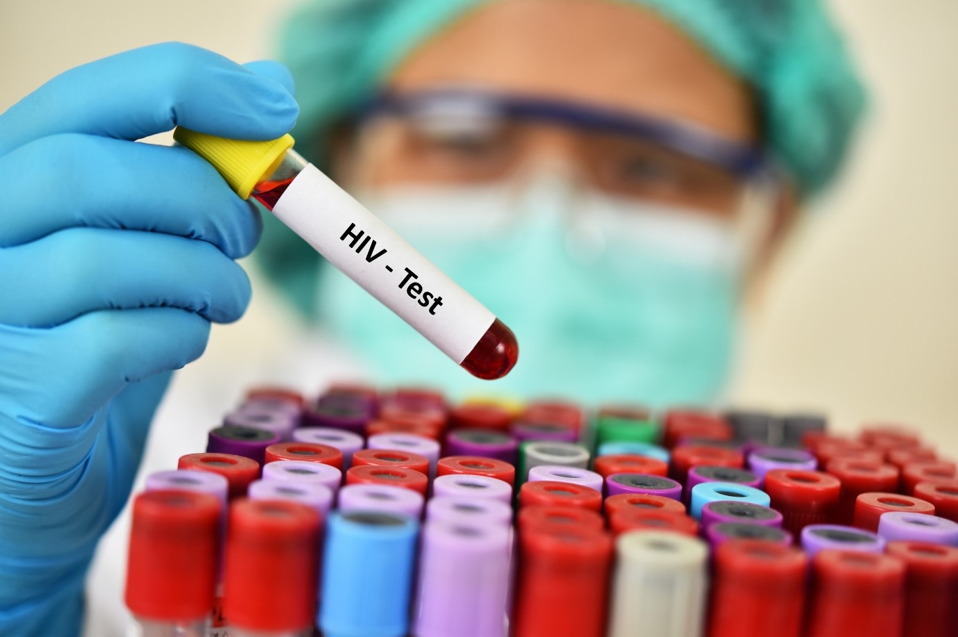 ¿POR QUÉ SE CURAN POCAS PERSONAS DE VIH? - Lorgen