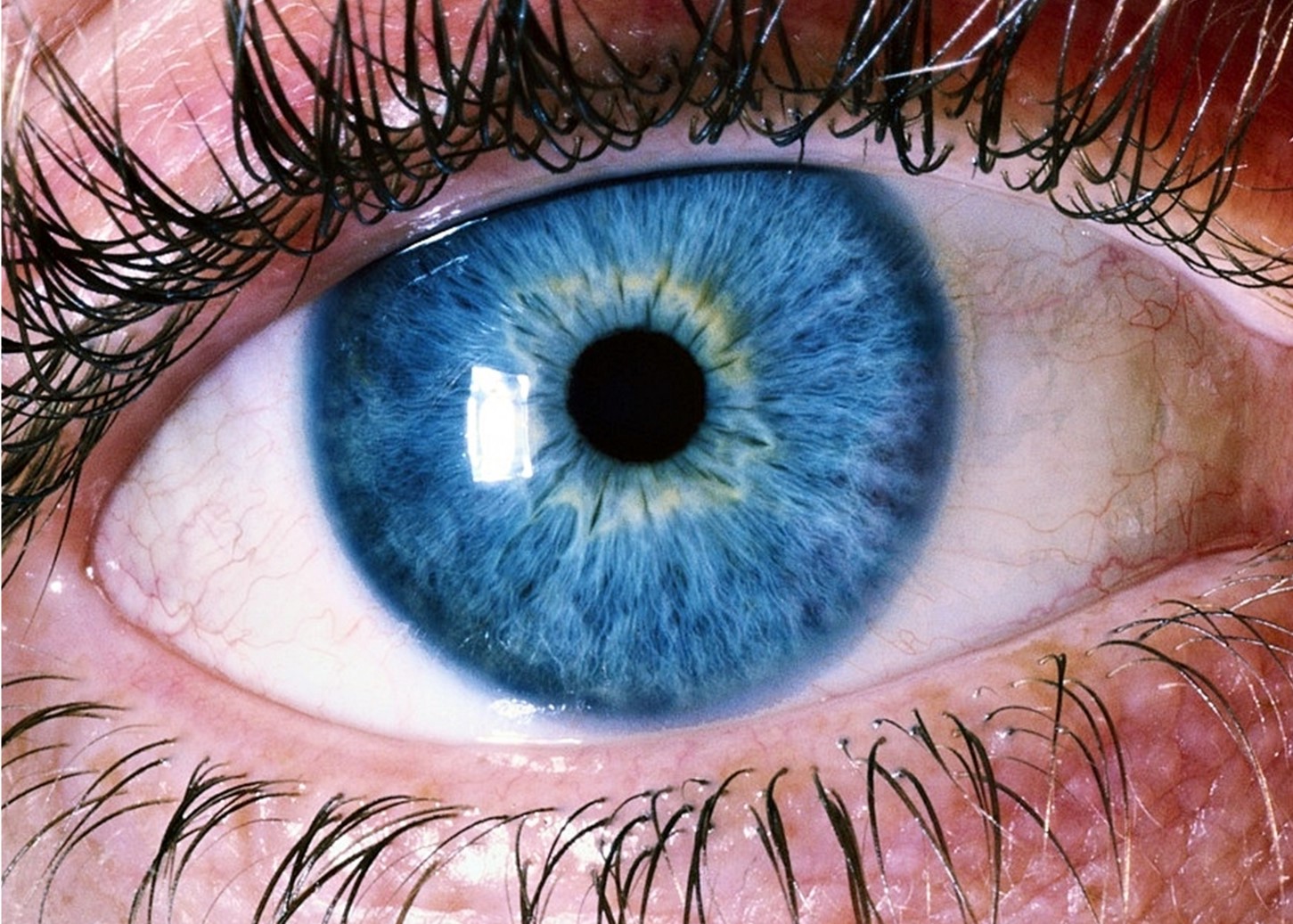 ¿Cómo se diagnostica actualmente la Retinosis Pigmentaria? - Lorgen