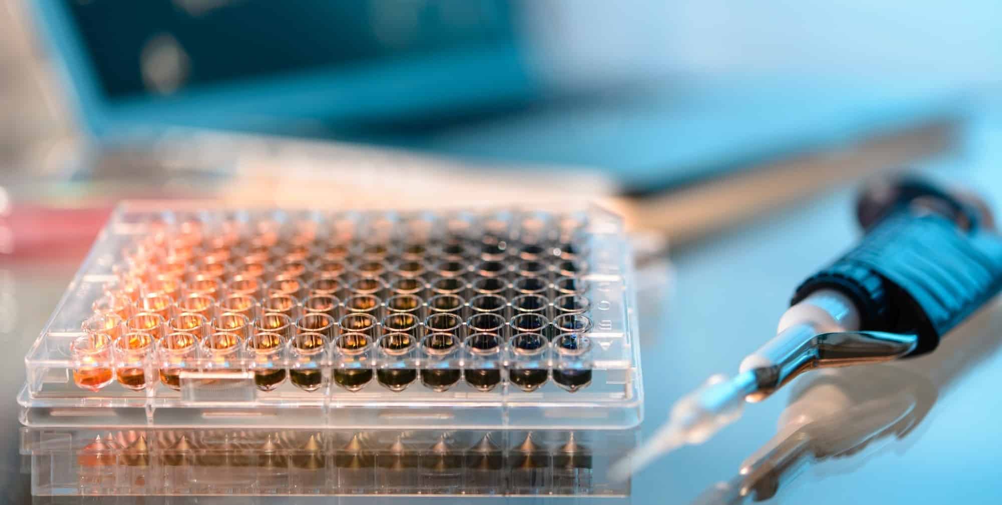 Avances tecnológicos en pruebas diagnósticas - Lorgen