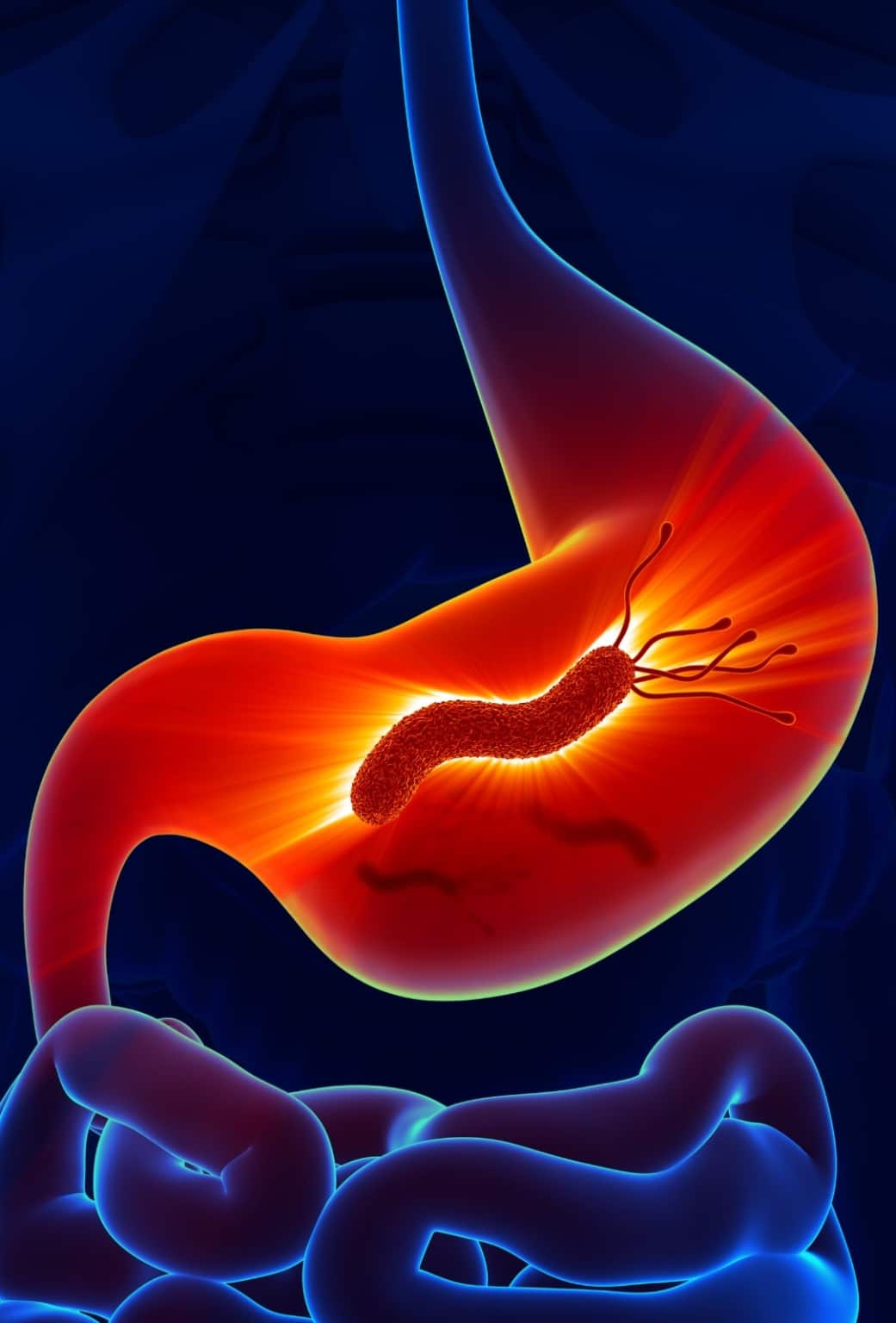 HELICOBACTER PYLORI: DETECCIÓN CON EL TEST DE AIRE - Lorgen