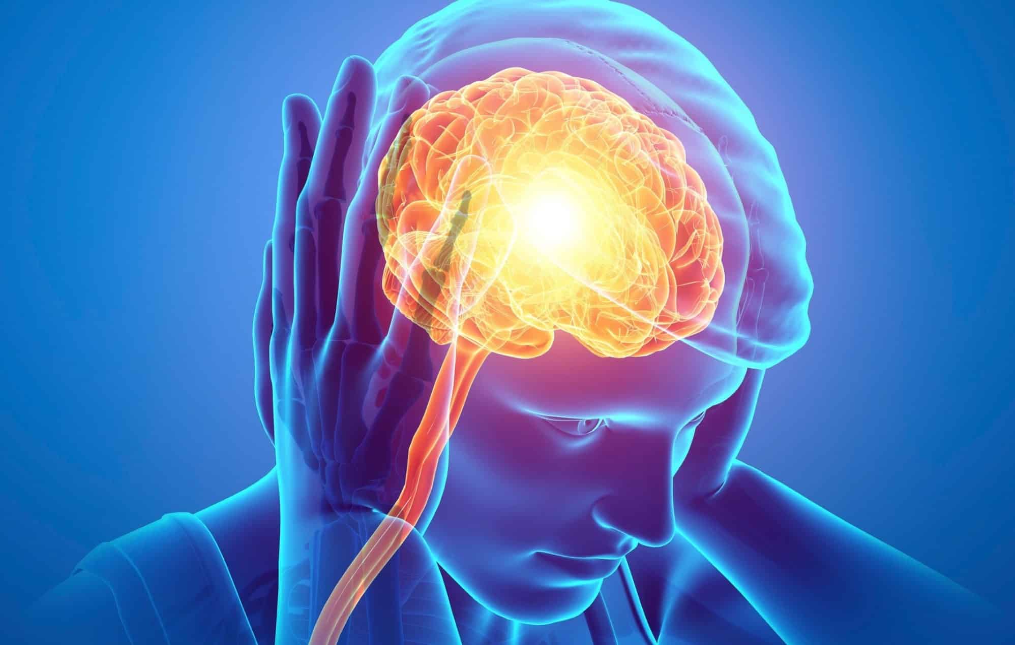 La conexión entre migraña y epilepsia - Lorgen