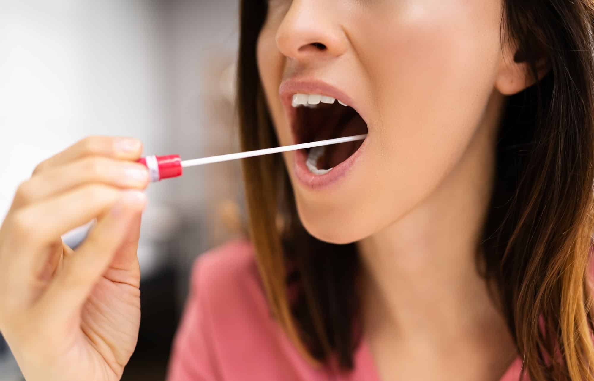 ¿Qué son las ETS? - Lorgen