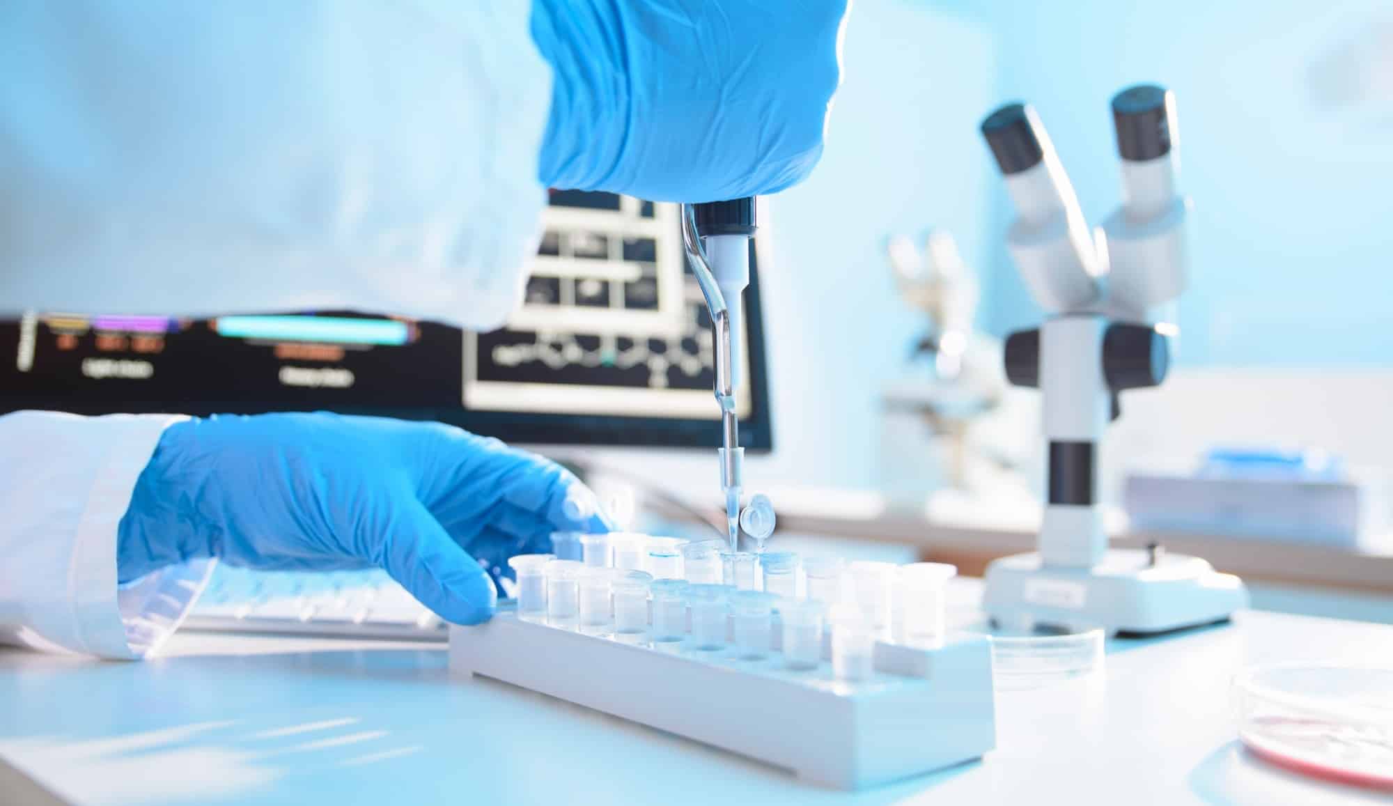 ¿Qué es el HRD y cómo se detecta? - Lorgen