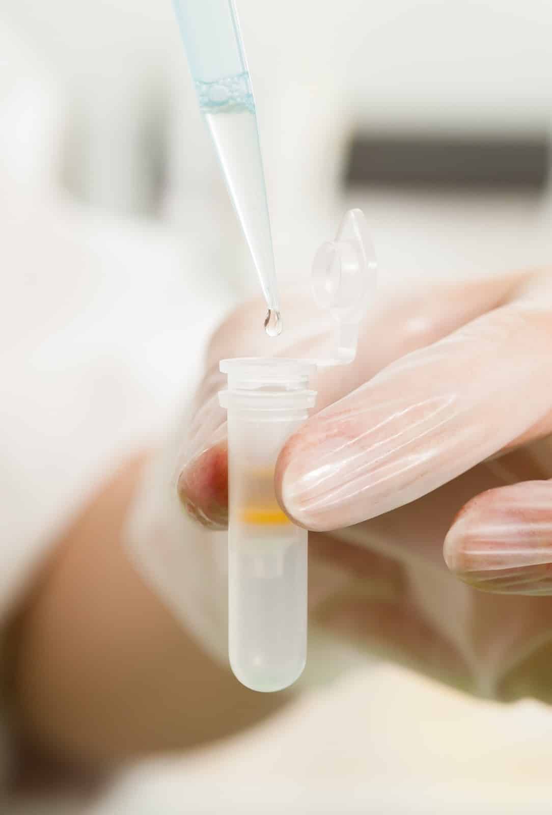 ¿QUÉ ES EL METAGENOMA? - Lorgen