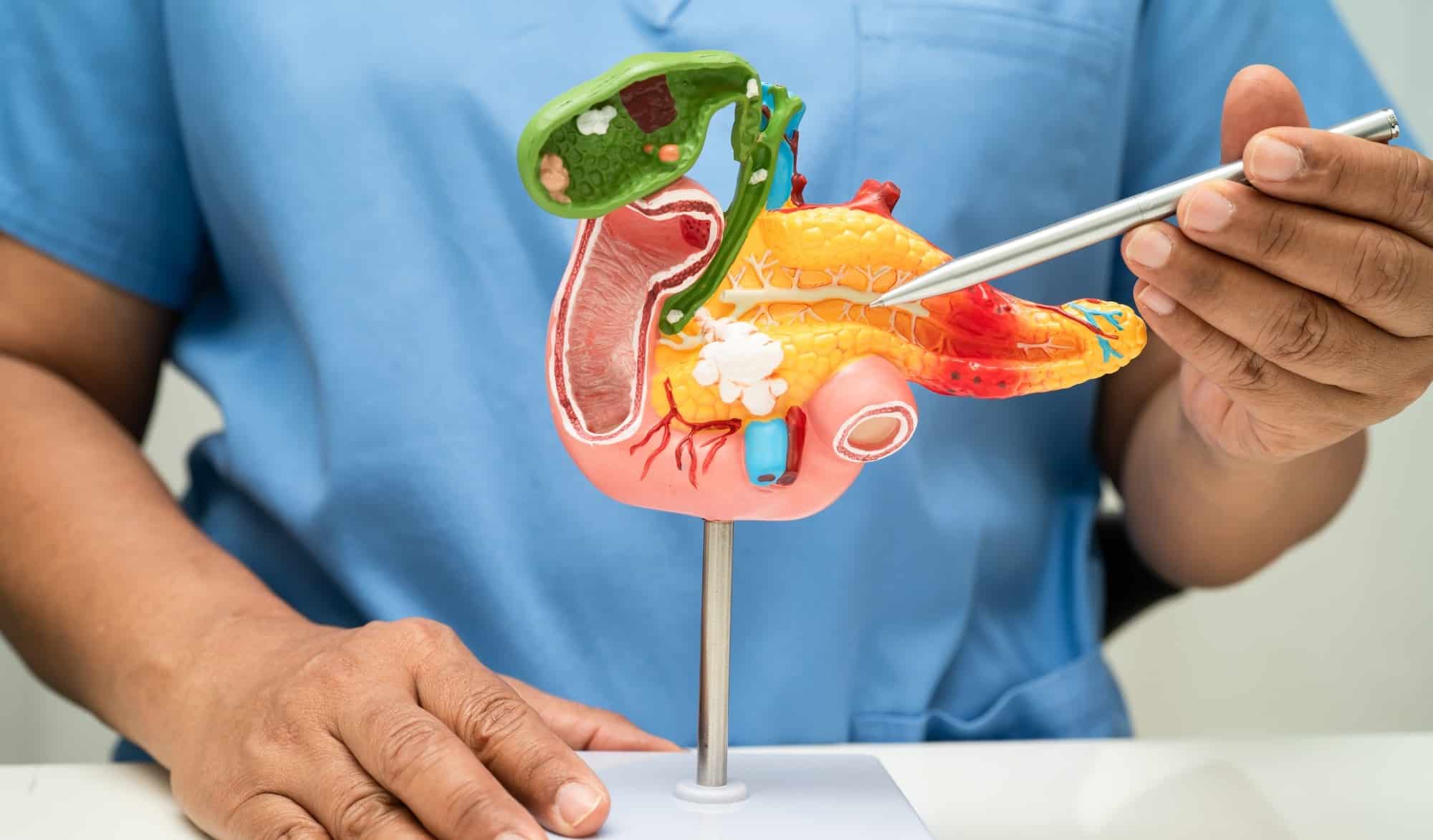 ¿Qué es la pancreatitis? - Lorgen