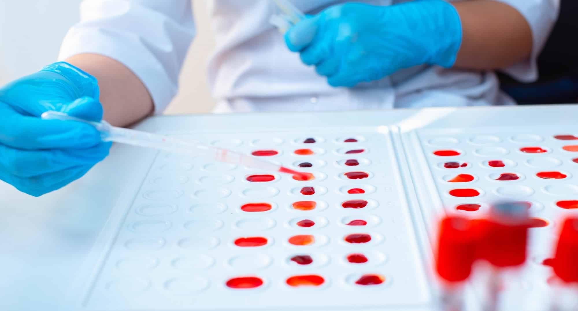 Grupos Sanguíneos: Lo Que Revela Tu Sangre - Lorgen